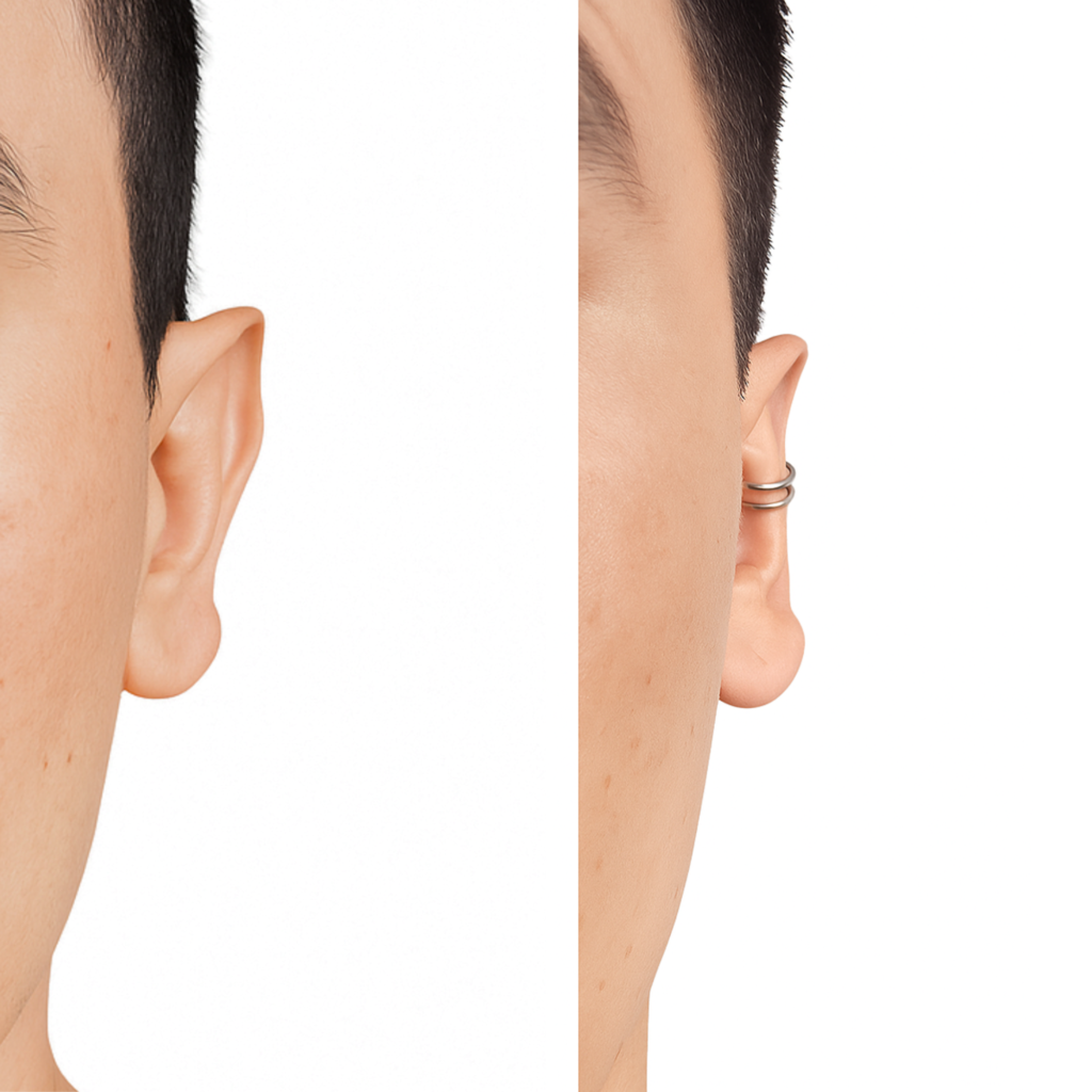 Corrector de Orejas Piercing doble CLIPPING - Clipping – Corrector de ...